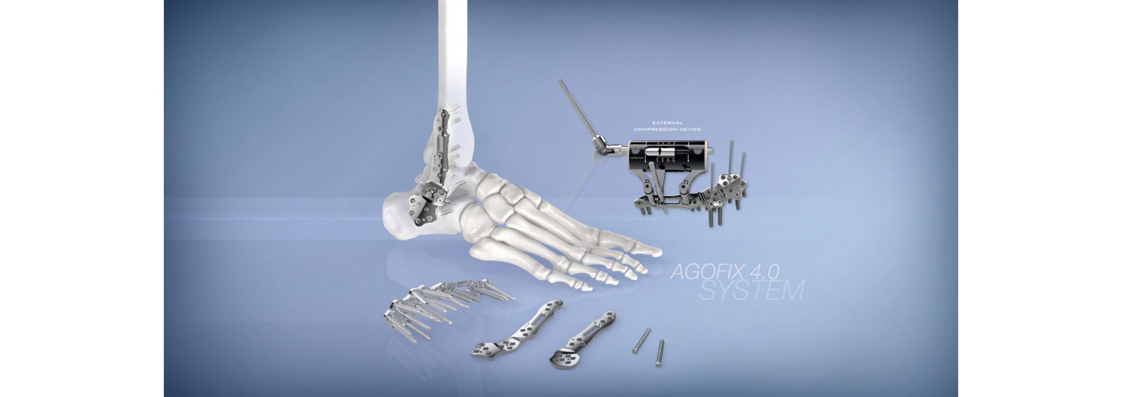 Agomed Implant System for Traumalogy and Orthopedics of Upper and Lower ...